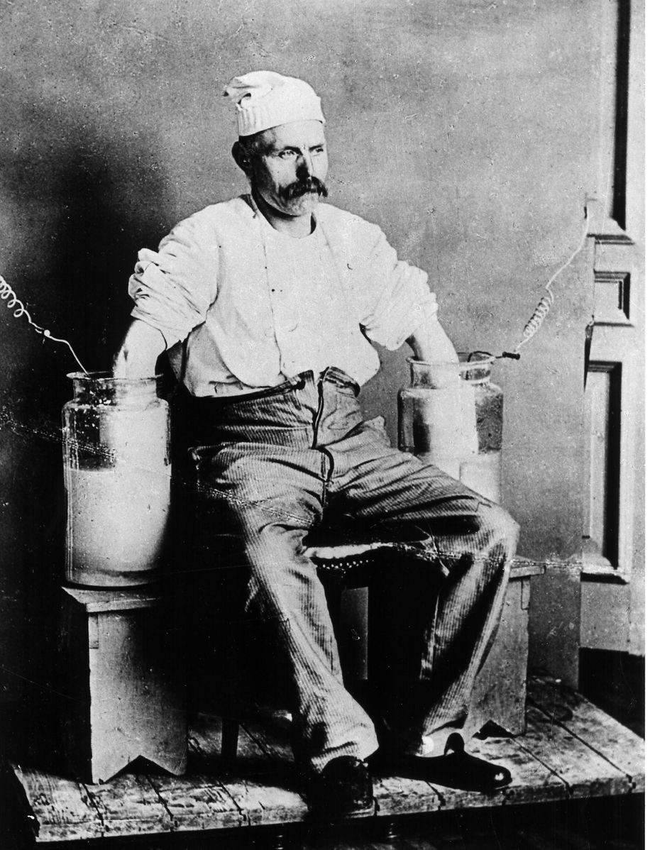 The Interesting History of EKGs