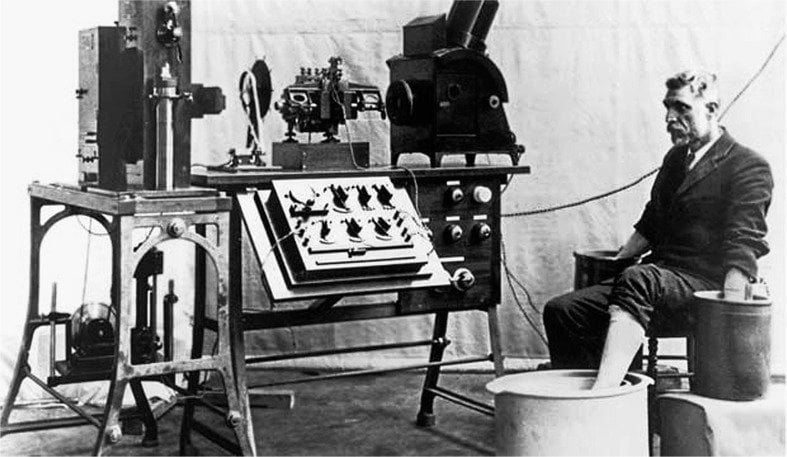 The Interesting History of EKGs